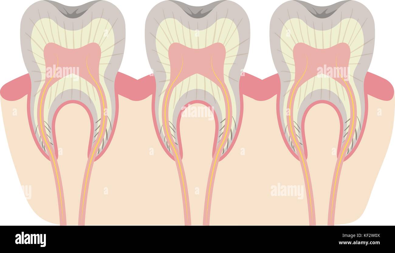 teeth with nerve and tooth root view colorful silhouette Stock Vector ...