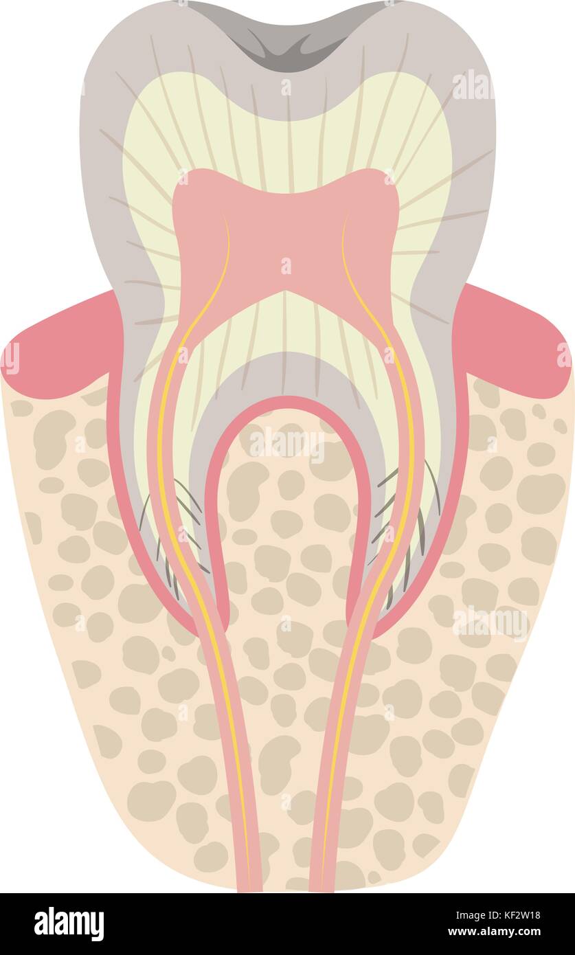 tooth with nerve and root view colorful silhouette Stock Vector Image ...
