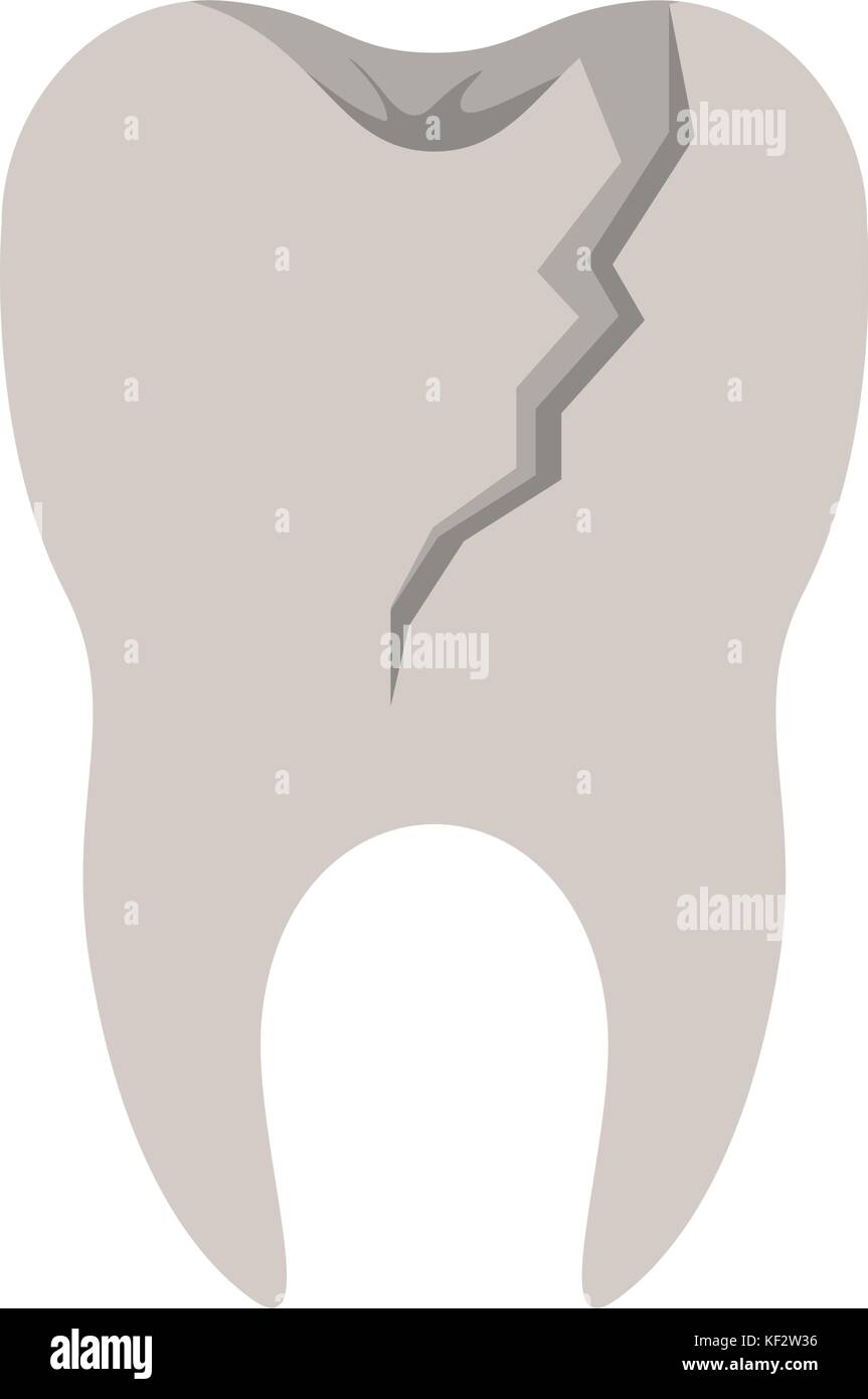 Broken tooth root in hi-res stock photography and images - Alamy