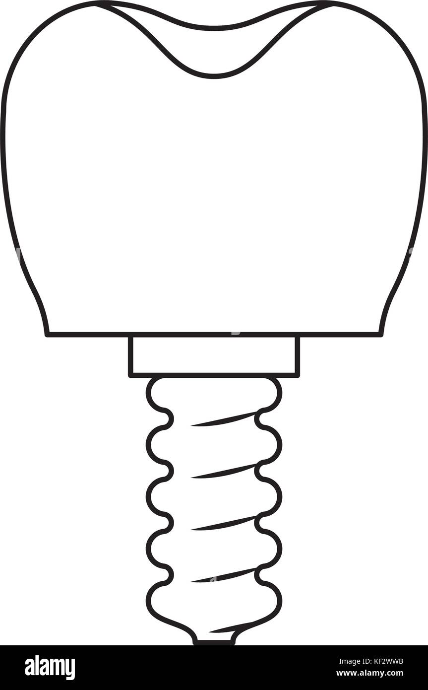 tooth implant with screw in monochrome silhouette Stock Vector Image ...