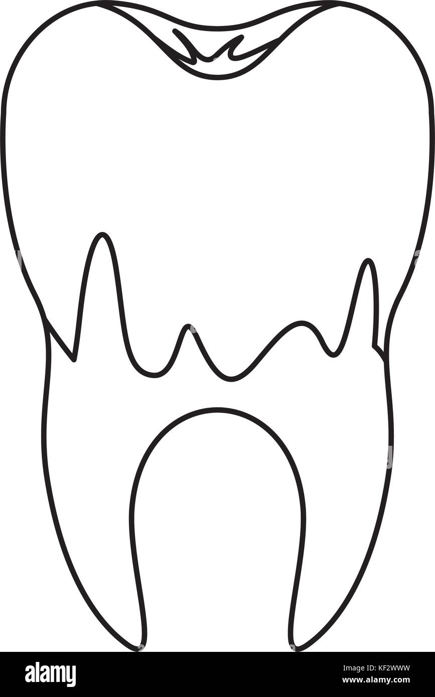 caries in the root of tooth in monochrome silhouette Stock Vector Image ...