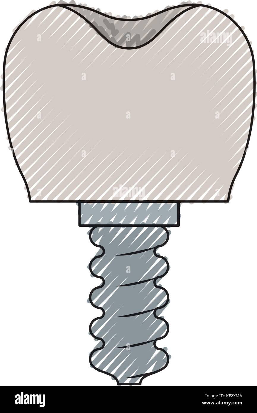 tooth implant with screw in colored crayon silhouette Stock Vector ...