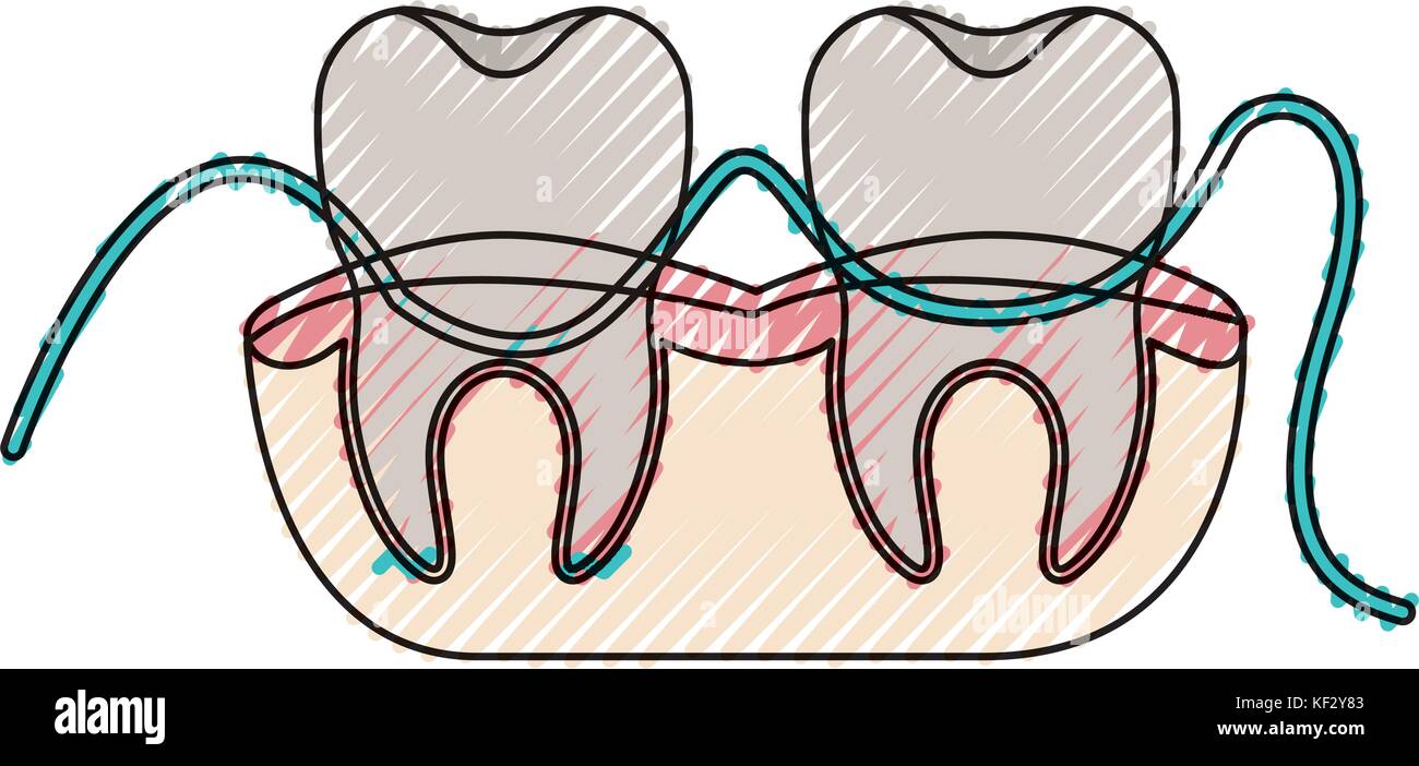 teeth and gums with dental floss between them in colored crayon ...