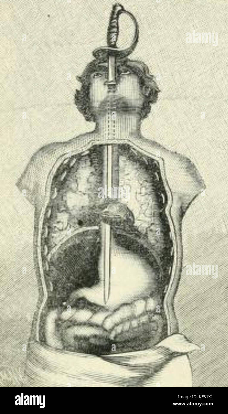 Sword inside a sword swallower Stock Photo - Alamy