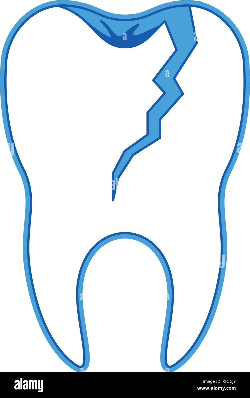 broken tooth with root in blue silhouette Stock Vector Image & Art - Alamy