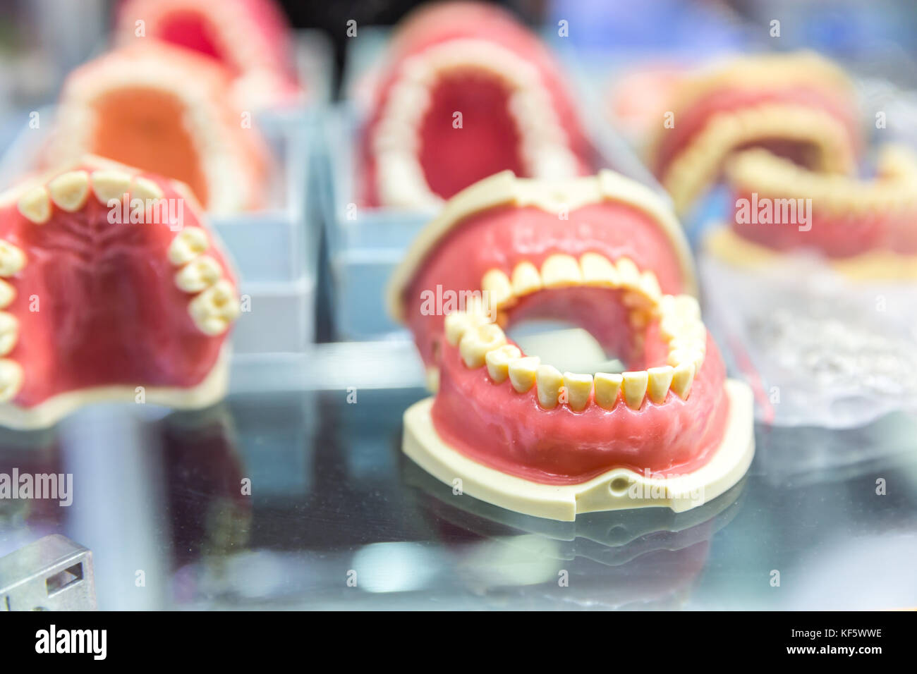 Dental, denture treatment, prosthetic dentistry Stock Photo - Alamy