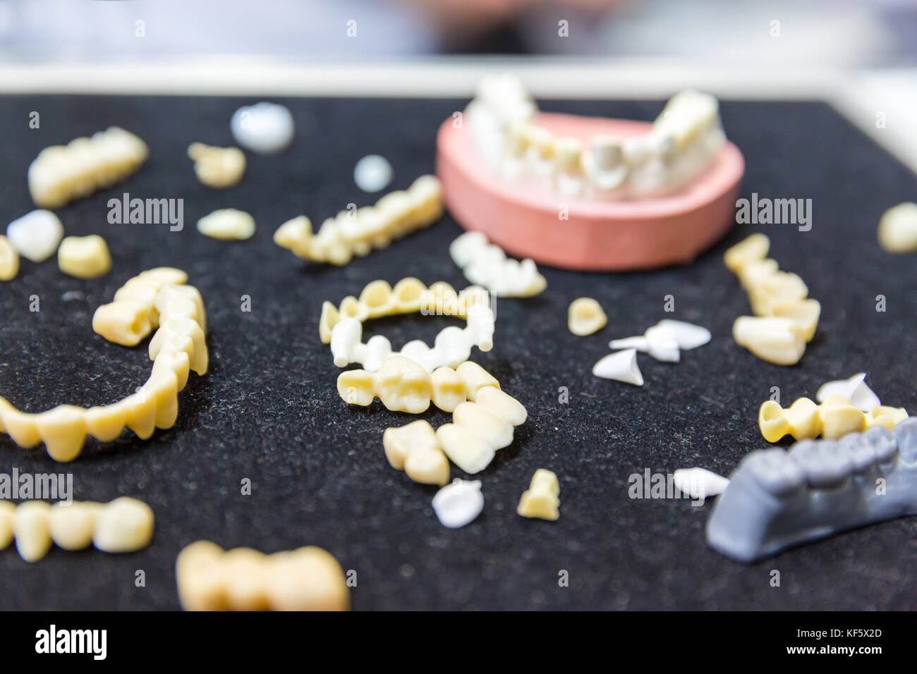 Denture treatment, prosthetic dentistry, implants Stock Photo - Alamy