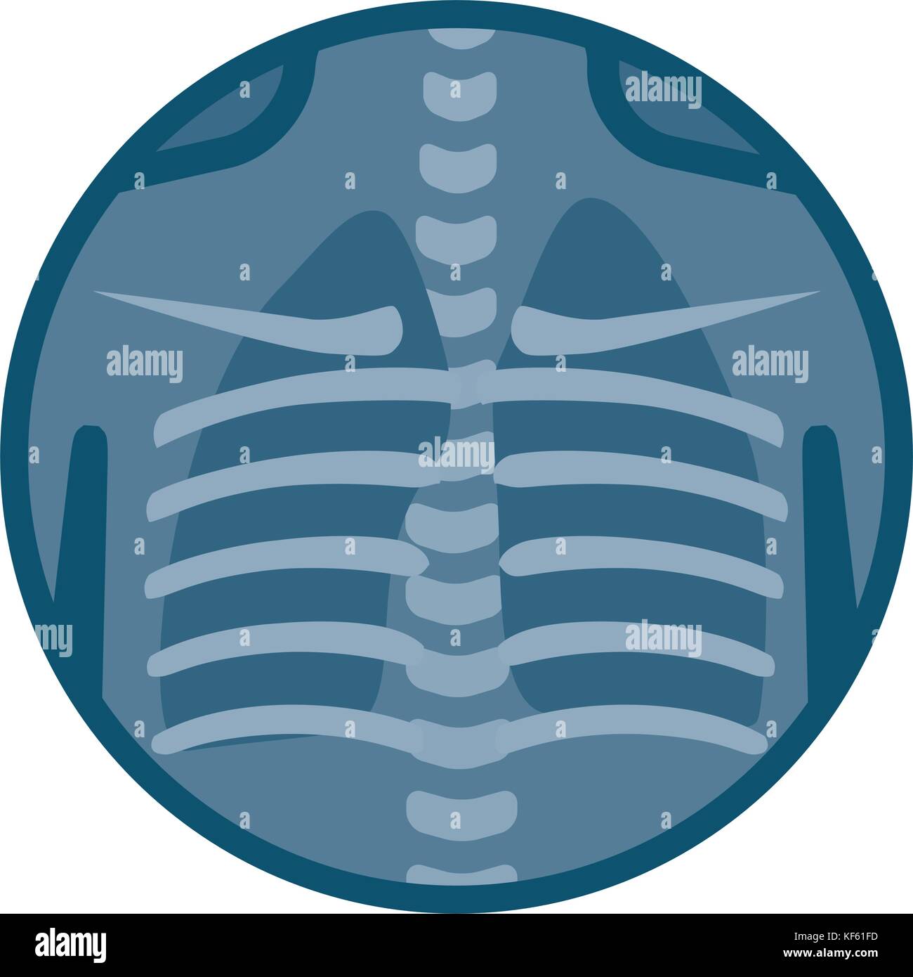 Healthy lungs chest x ray Stock Vector Images - Alamy