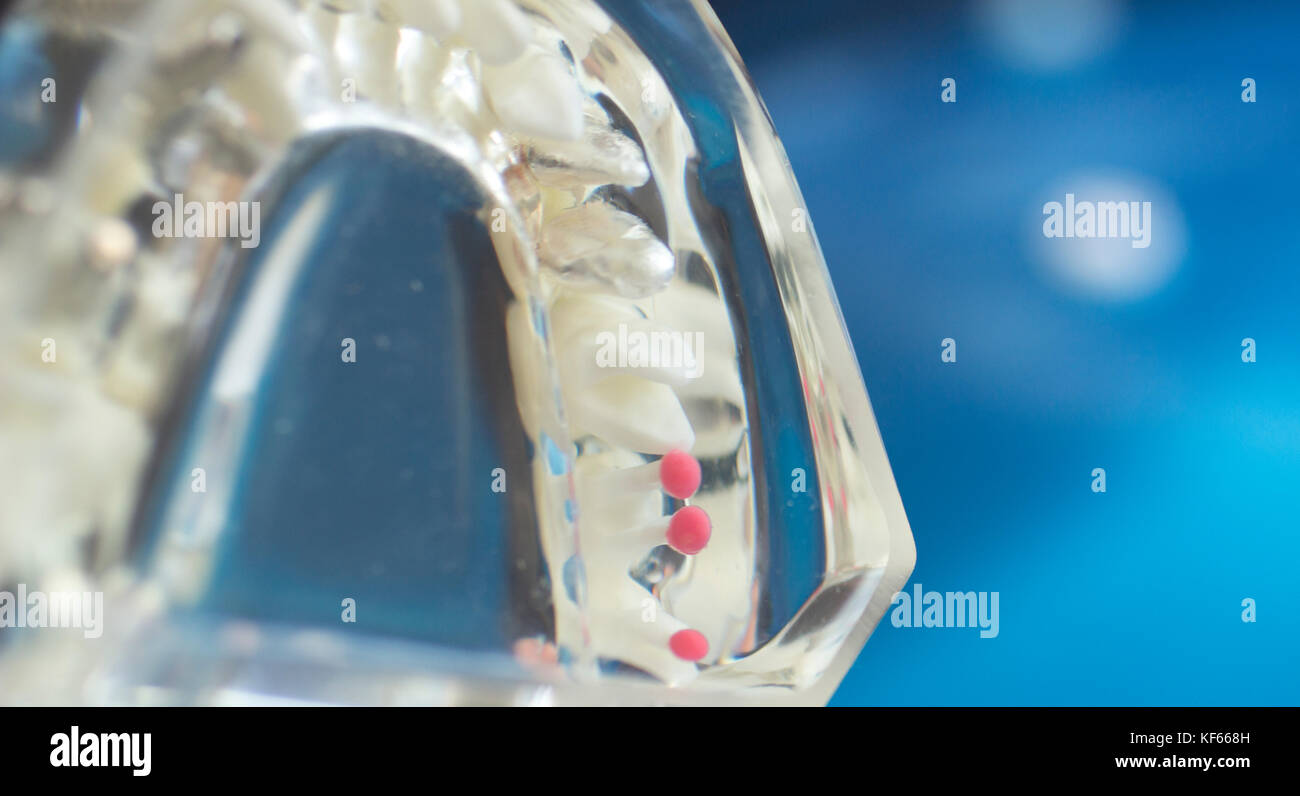 Dental teeth mouth dentists teaching model with teeth, gums, molars and ...