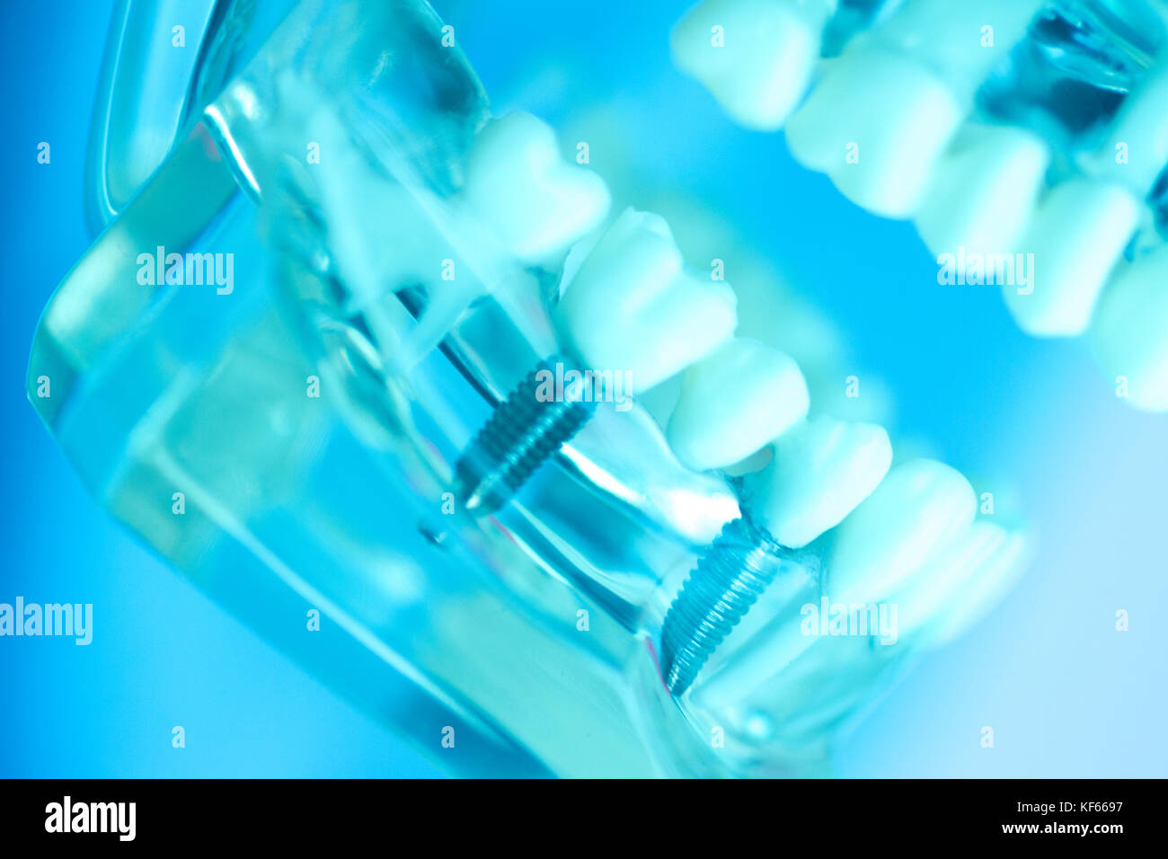 Dental teeth mouth dentists teaching model with teeth, gums, molars and ...