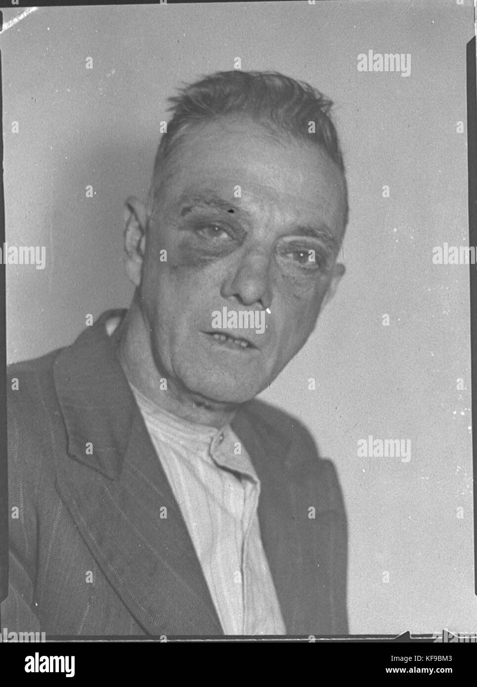 30710 Black eye taken for Mr Finlay Stock Photo - Alamy