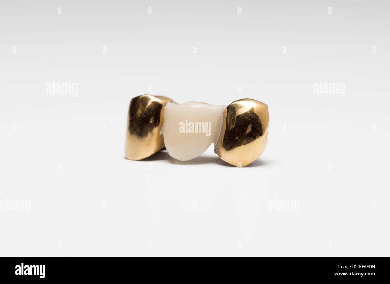 Steel artificial dental crown for dentition restoration Stock Photo - Alamy