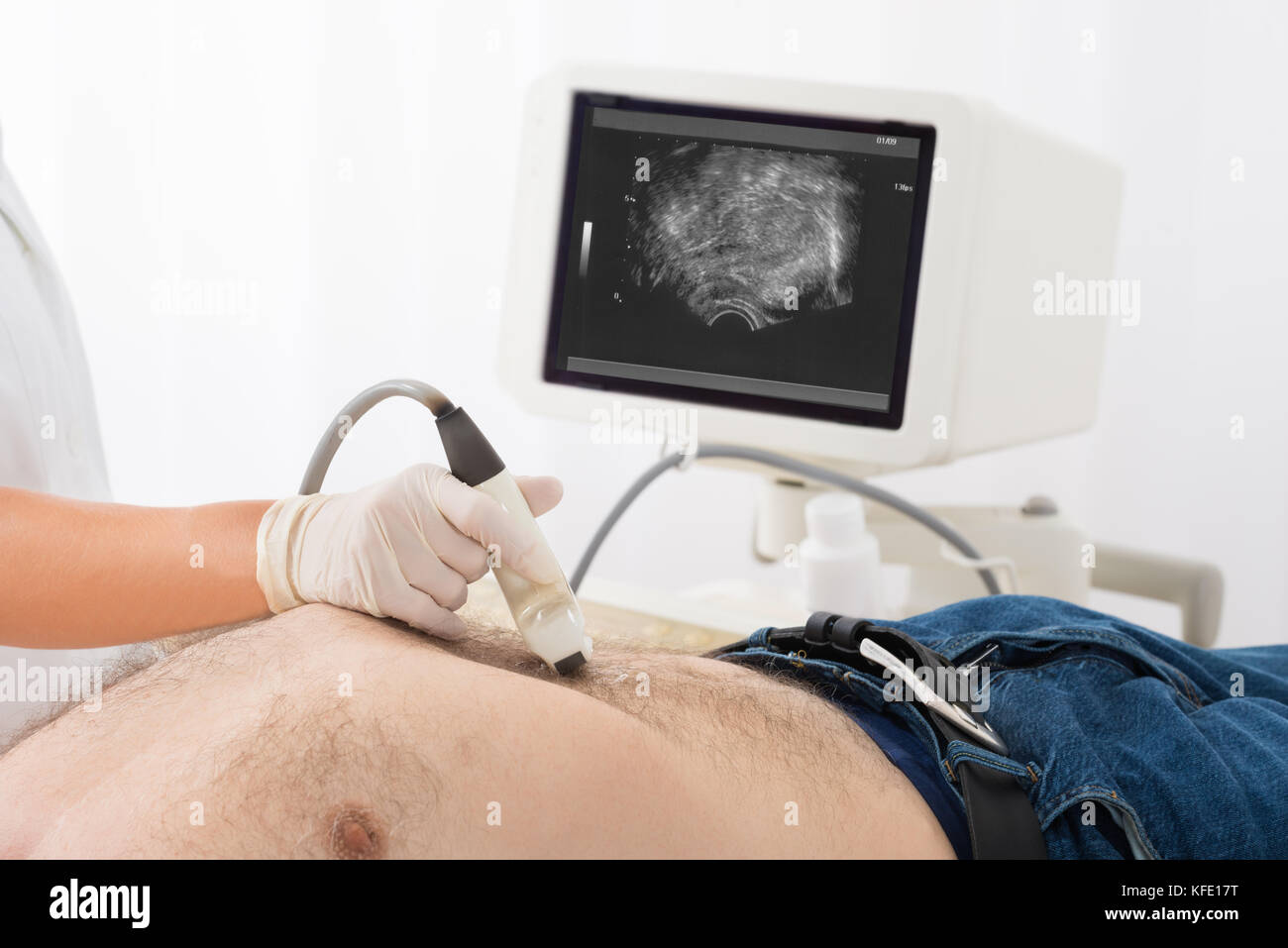 Close-up Of Doctor's Hand With Ultrasound Scan On Abdomen Of Male ...