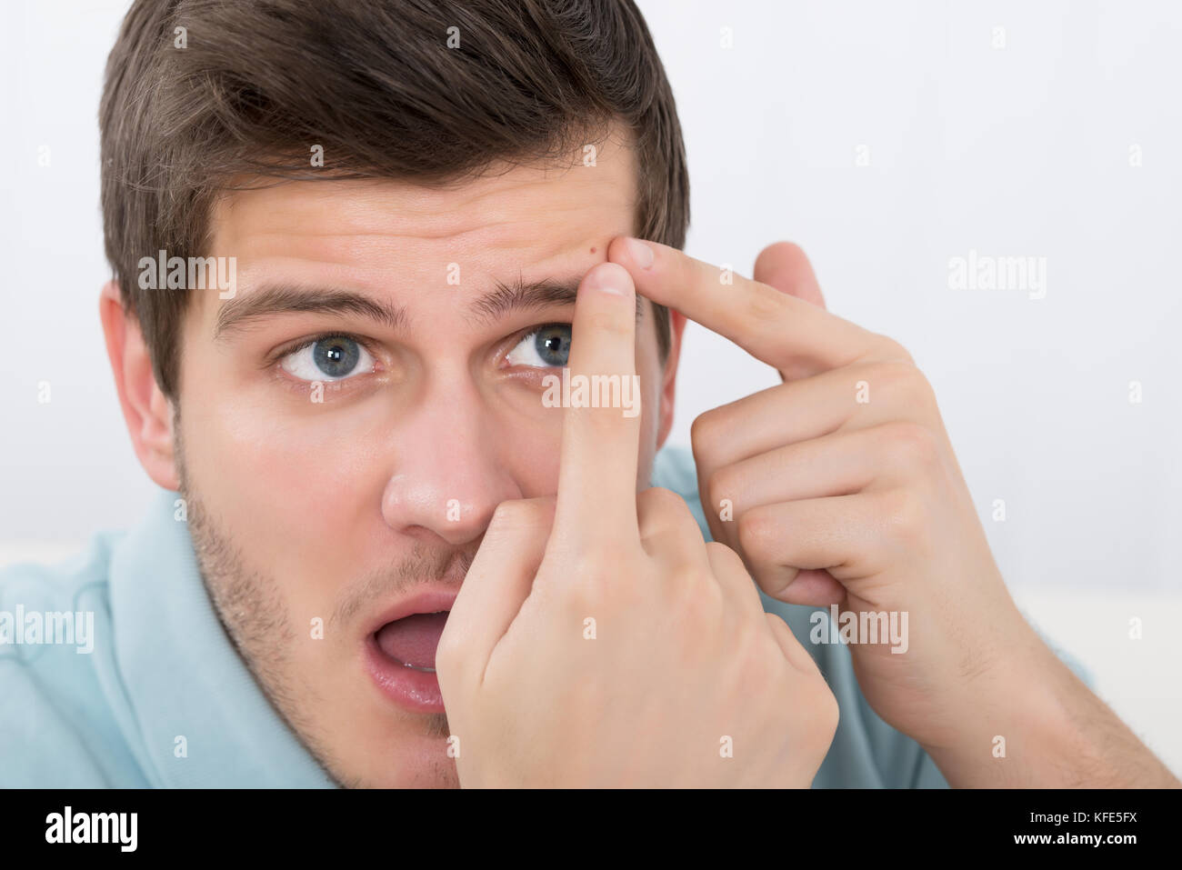 Shocked Young Man Looking At Pimple On Forehead Stock Photo - Alamy