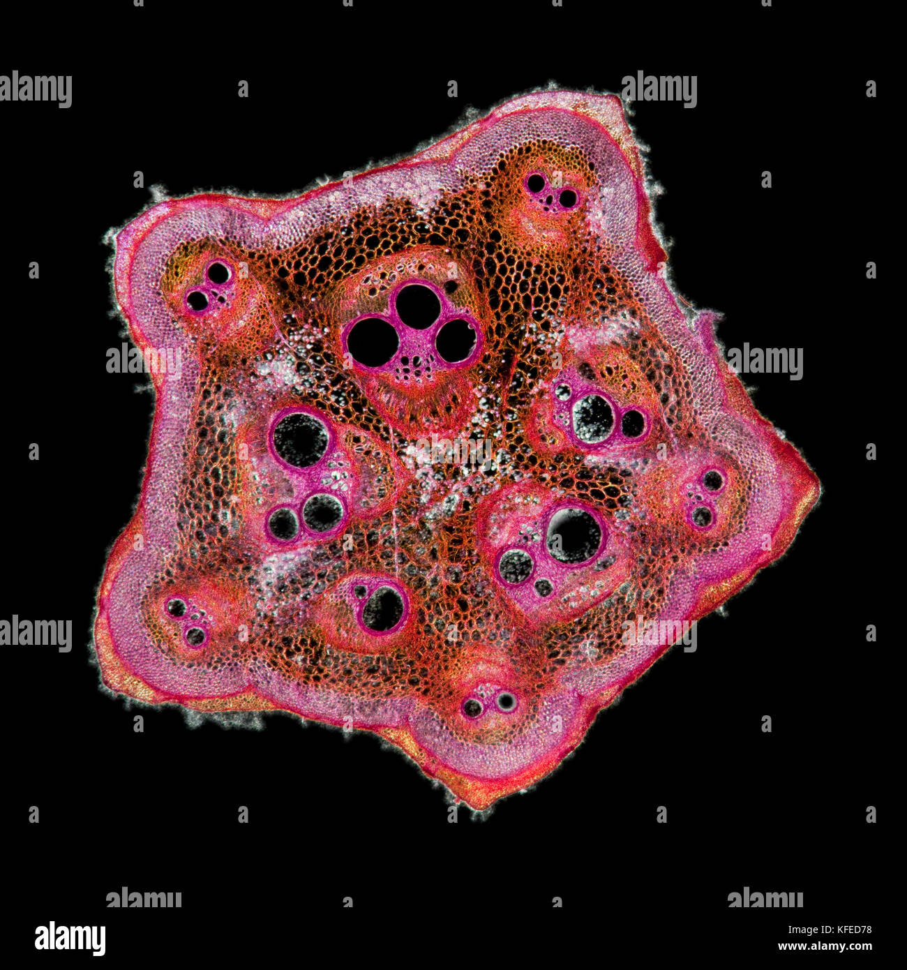 Sponge gourd darkfield photomicrograph hi-res stock photography and ...