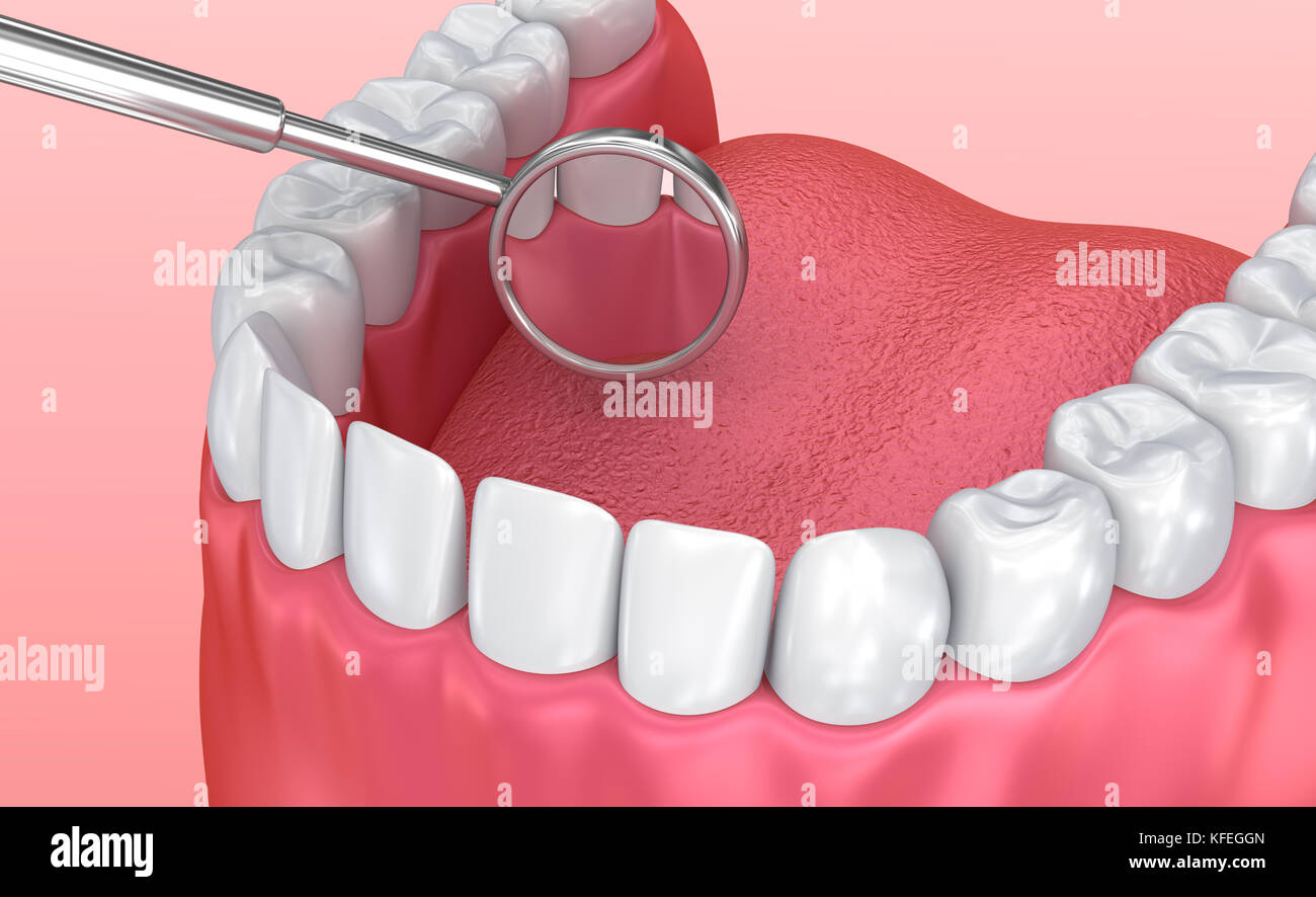 Teeth inspection with mirror. Medically accurate tooth 3D illustration ...