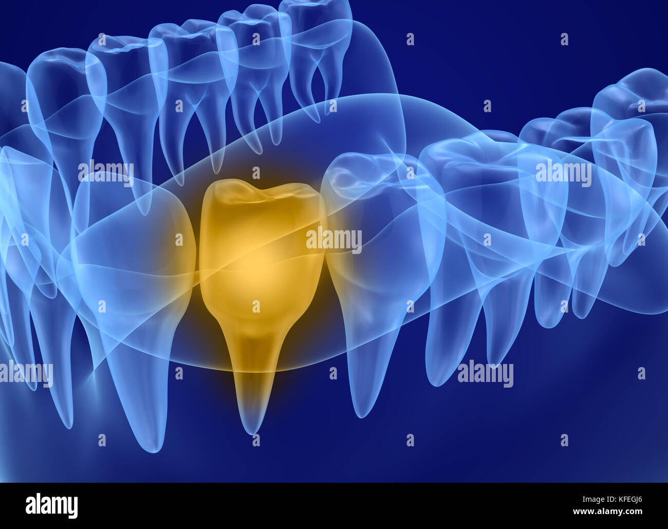 Teeth xray hi-res stock photography and images - Alamy