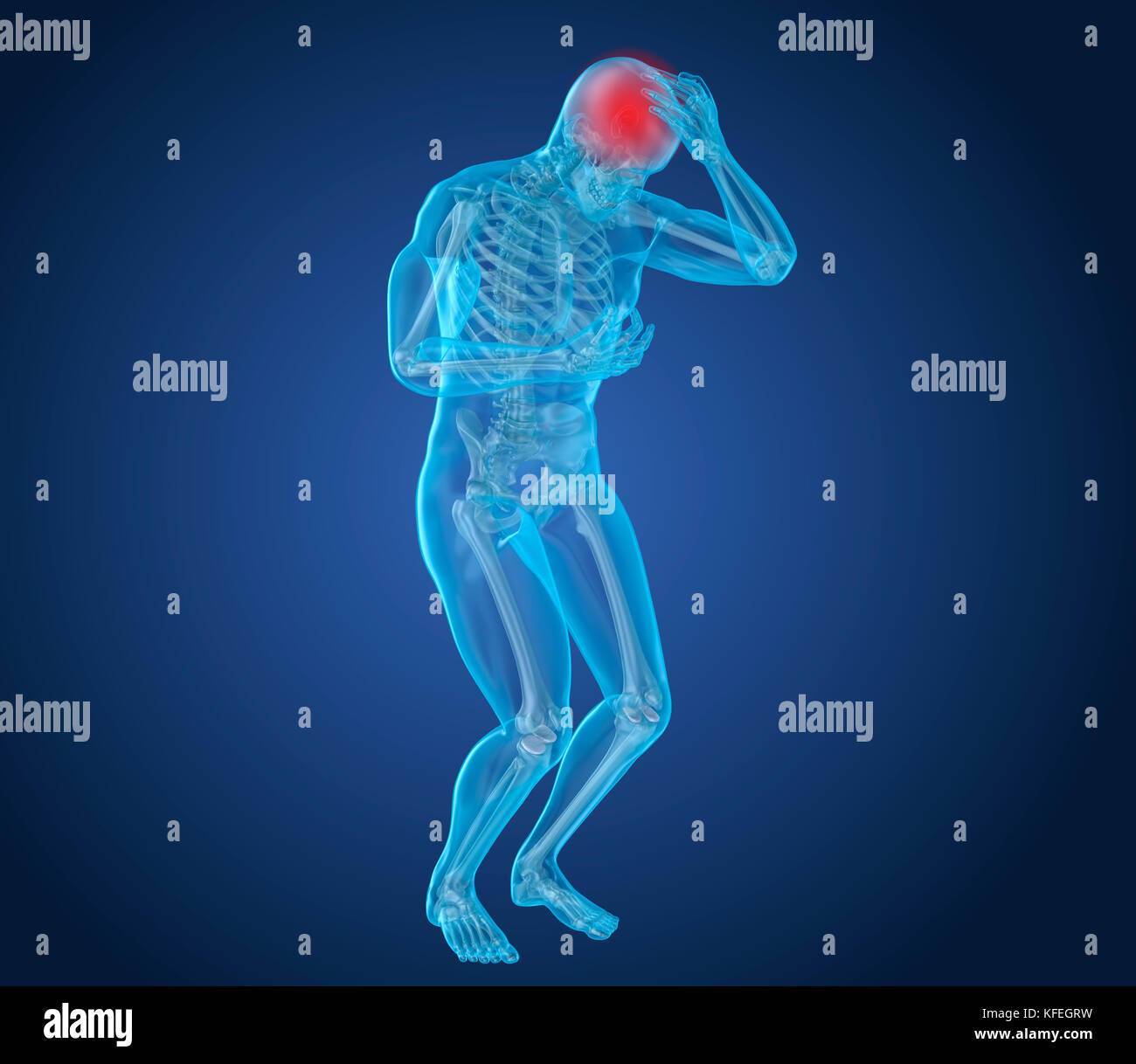 Head pain Attack, man suffering from brain pain. 3D illustration Stock ...