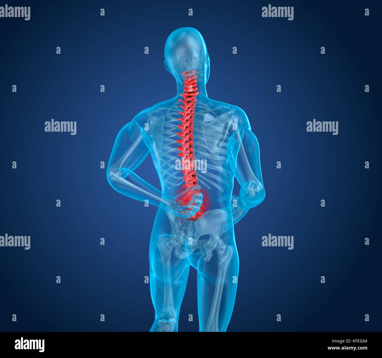 Spinal pain Attack, man suffering from spinal pain. 3D illustration ...