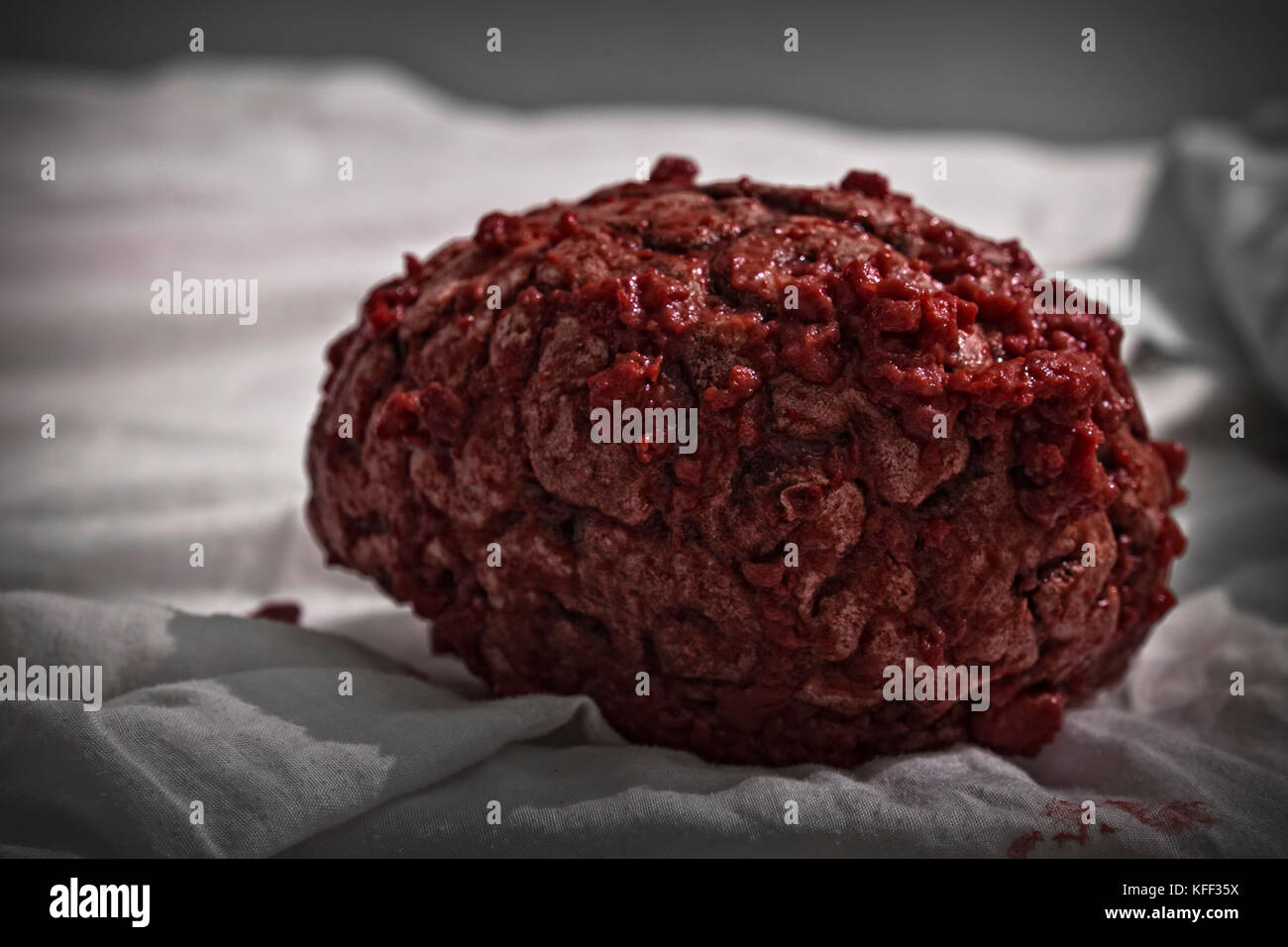 Human brain fresh out of a corpse during an autopsy Stock Photo - Alamy