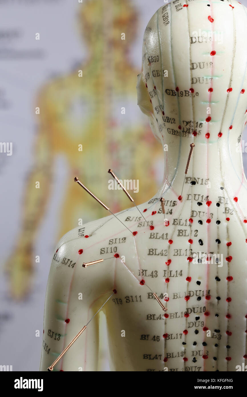 Female acupuncture model hi-res stock photography and images - Alamy