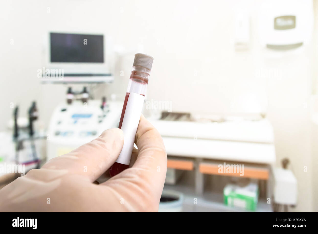 Smart healthcare medical concept. Hand doctor holding gray blood tube ...