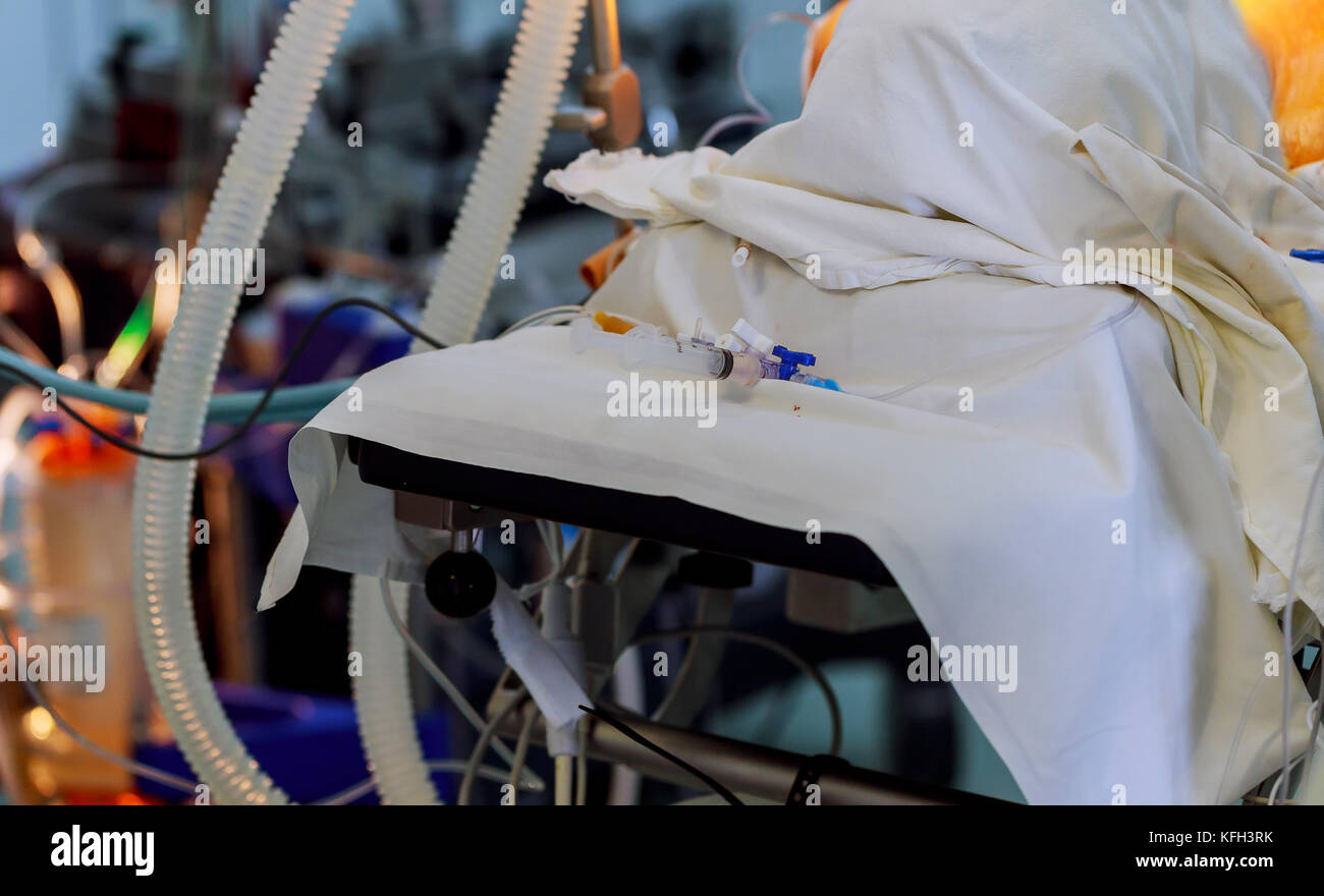 Doctor preparing for vein surgery preparing a patient for surgery Stock ...