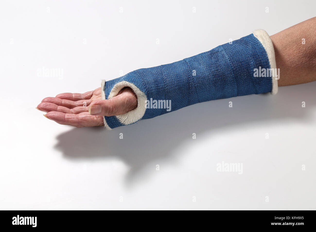 Broken wrist hi-res stock photography and images - Alamy
