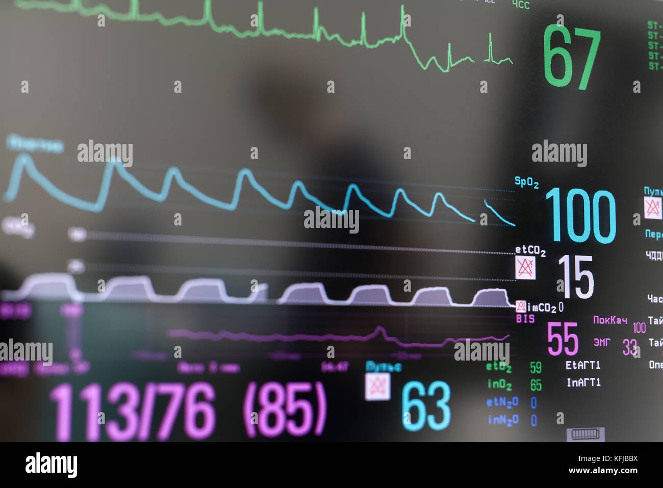 Ekg monitor hi-res stock photography and images - Alamy