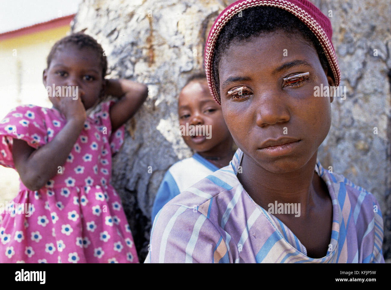 Inverted eyelashes hi-res stock photography and images - Alamy