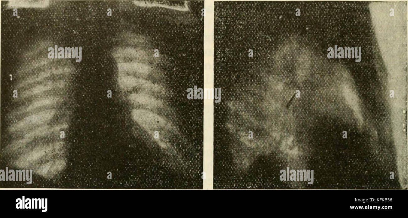 "Modern surgery, general and operative" (1919 Stock Photo - Alamy