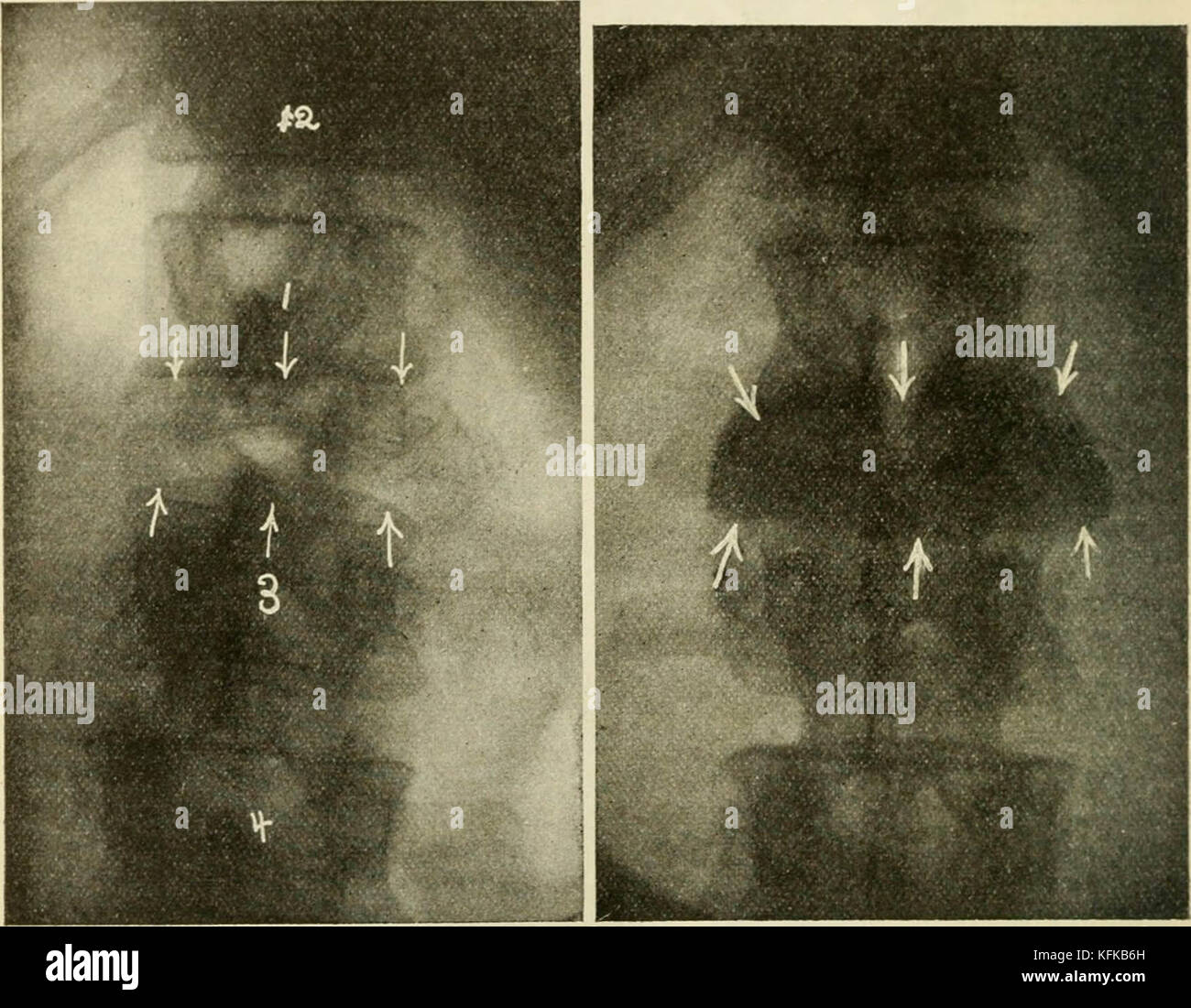 "Modern surgery, general and operative" (1919 Stock Photo - Alamy