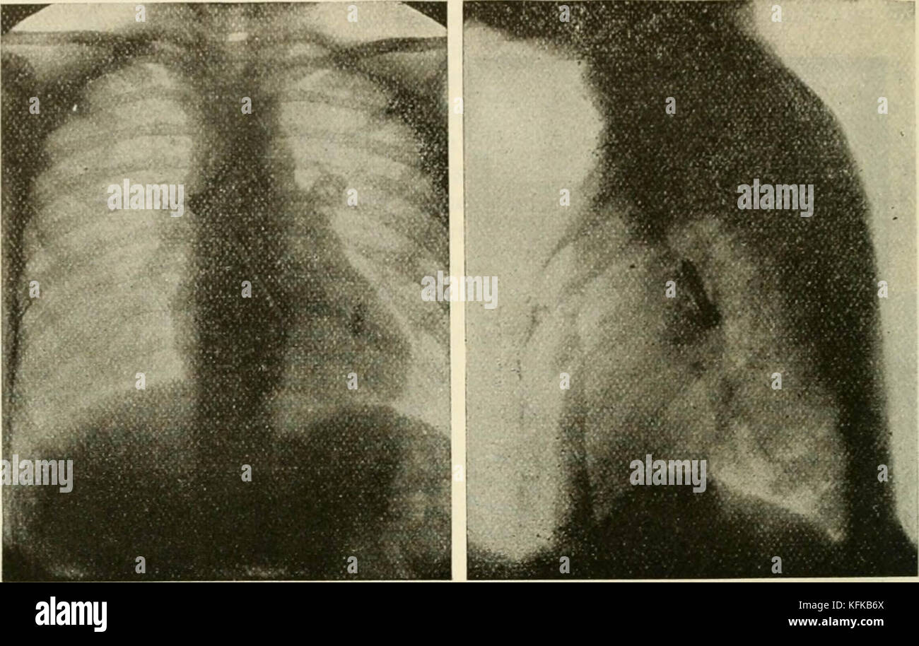 "Modern surgery, general and operative" (1919 Stock Photo - Alamy