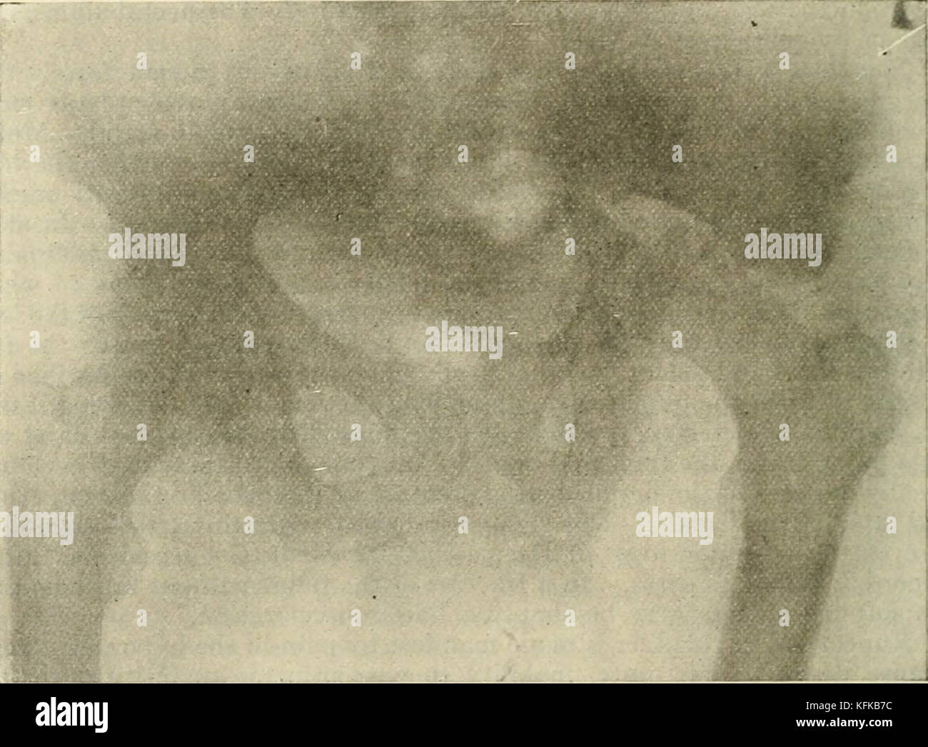 Modern surgery general operative hi-res stock photography and images ...