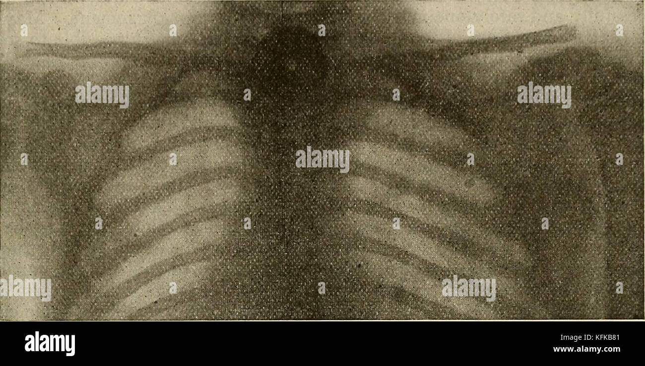 "Modern surgery, general and operative" (1919 Stock Photo - Alamy
