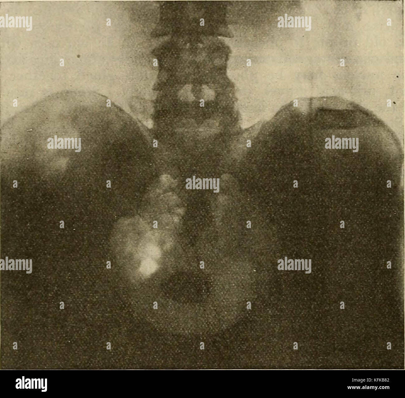 "Modern surgery, general and operative" (1919 Stock Photo - Alamy