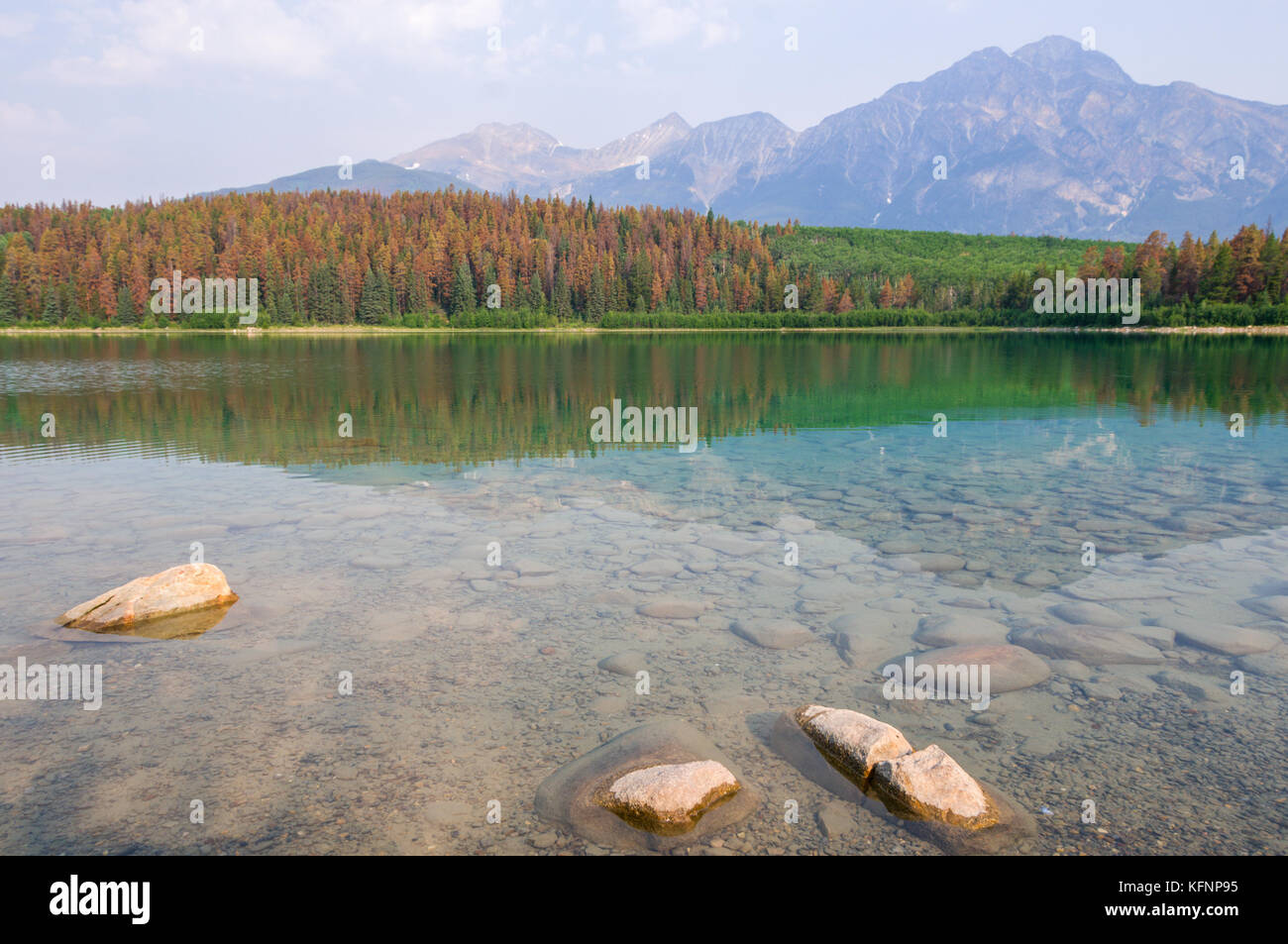 Patricia Lake, Jasper National Park Stock Photo - Alamy