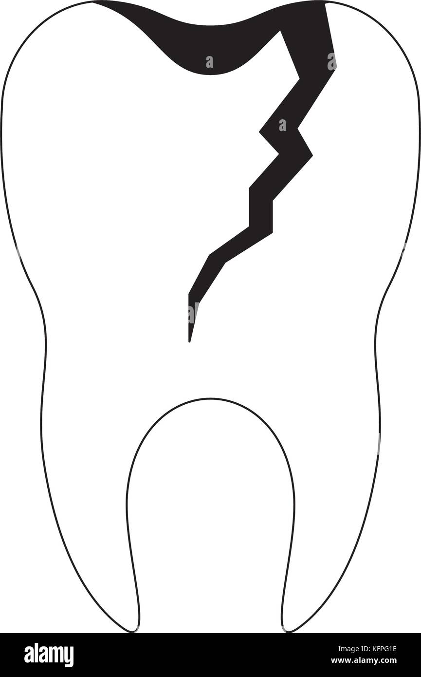 broken tooth with root in black silhouette Stock Vector Image & Art - Alamy