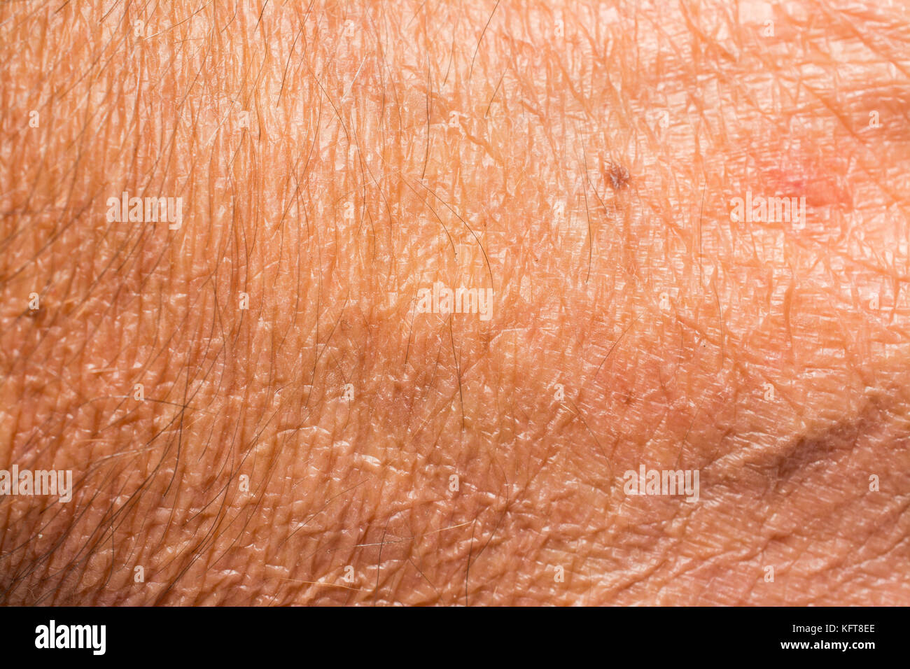 Texture of the skin with wrinkles on the body of mature male Stock ...