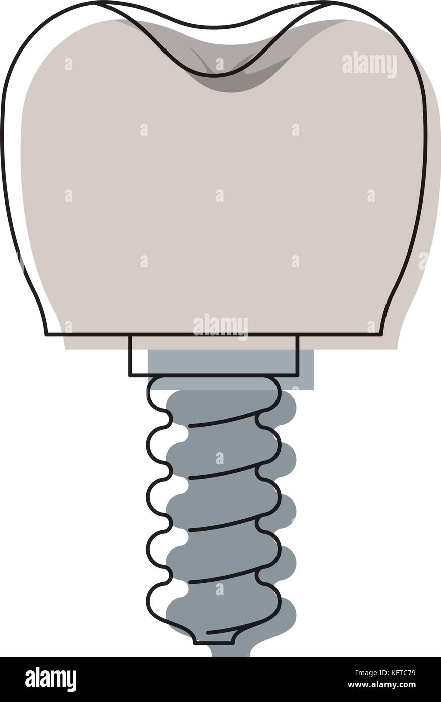 tooth implant with screw in watercolor silhouette Stock Vector Image ...