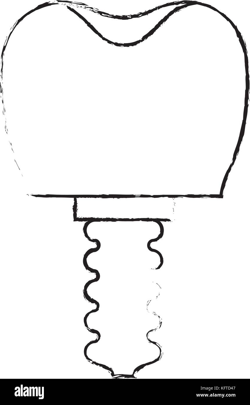 tooth implant with screw in monochrome blurred silhouette Stock Vector ...