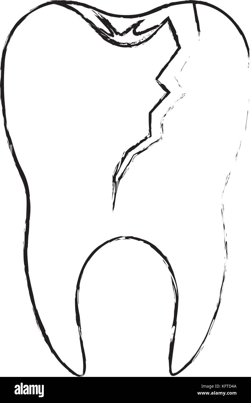 broken tooth with root in monochrome blurred silhouette Stock Vector ...