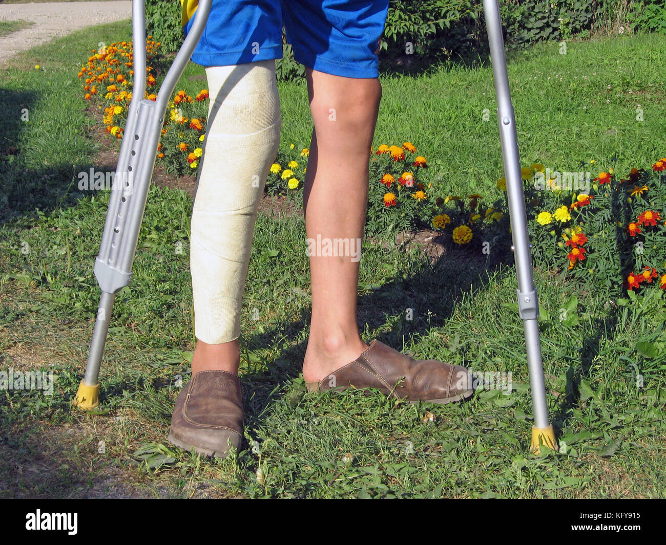 Person with leg in bandage and two crutches Stock Photo - Alamy