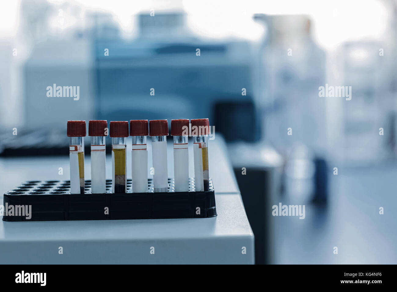 Close up of test tubes filled with different liquids Stock Photo - Alamy
