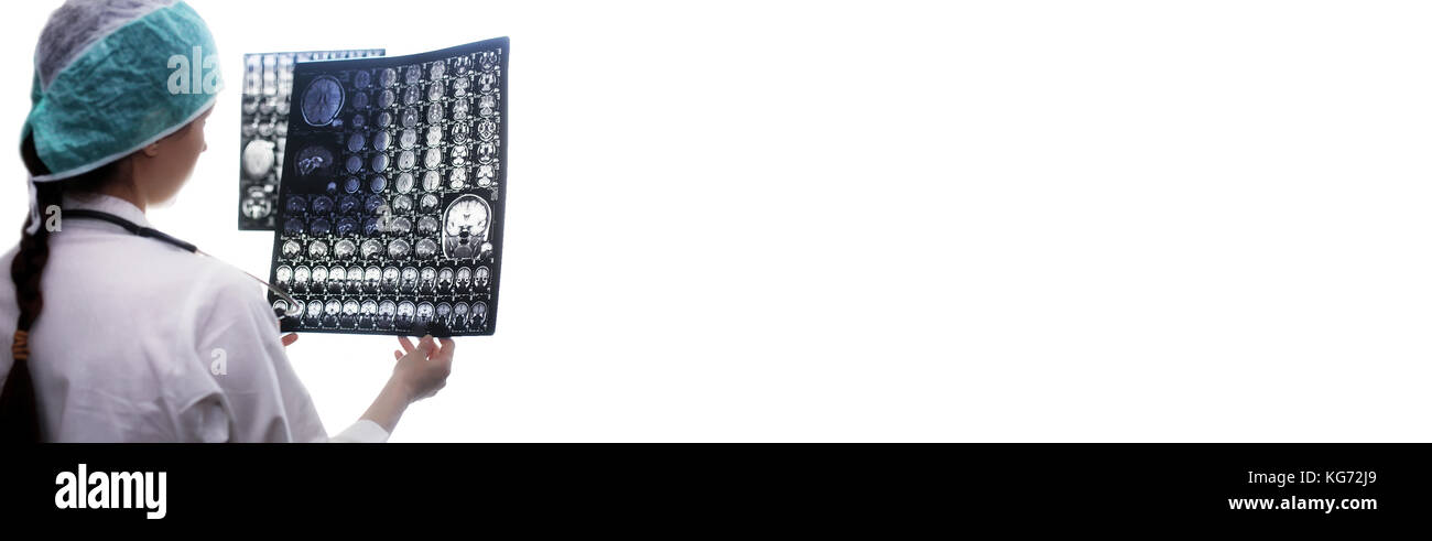 isolated poster with doctor holding a picture of a brain MRI workflow ...