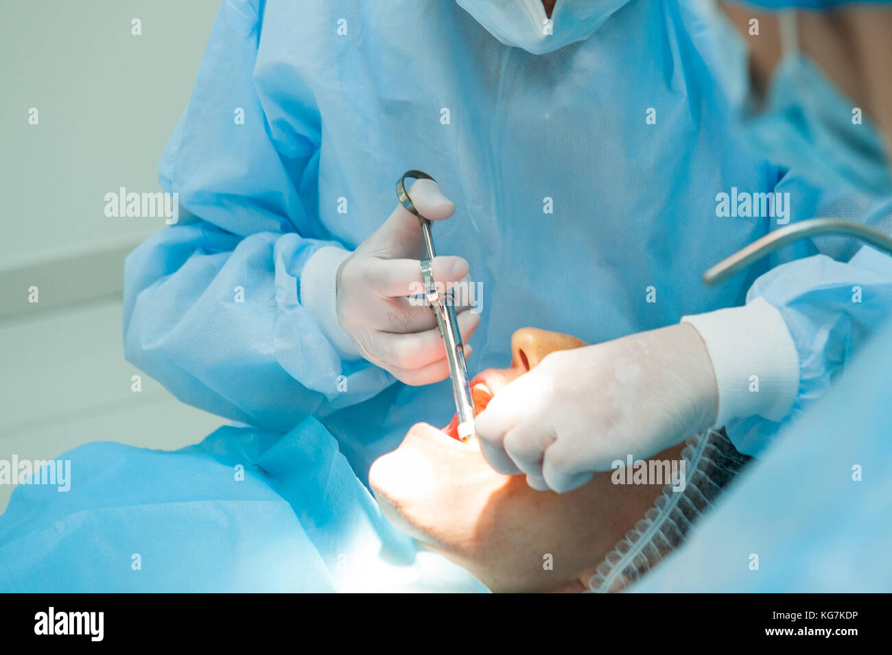 Close up dental surgery process - Implantation. Dentist surgeon with ...