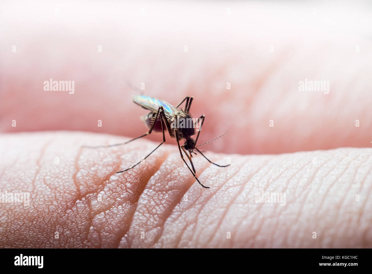 Yellow Fever, Malaria or Zika Virus Infected Mosquito Insect Bite Stock ...