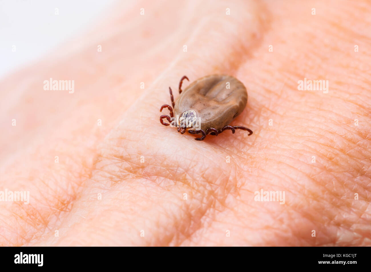 Parasitic mite infection of the skin hi-res stock photography and ...