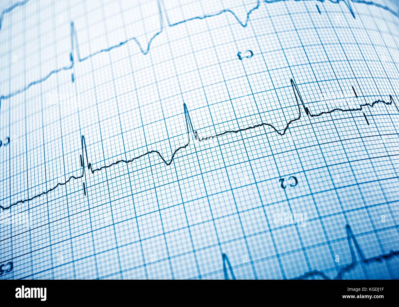 Close up of an electrocardiogram in paper form Stock Photo - Alamy