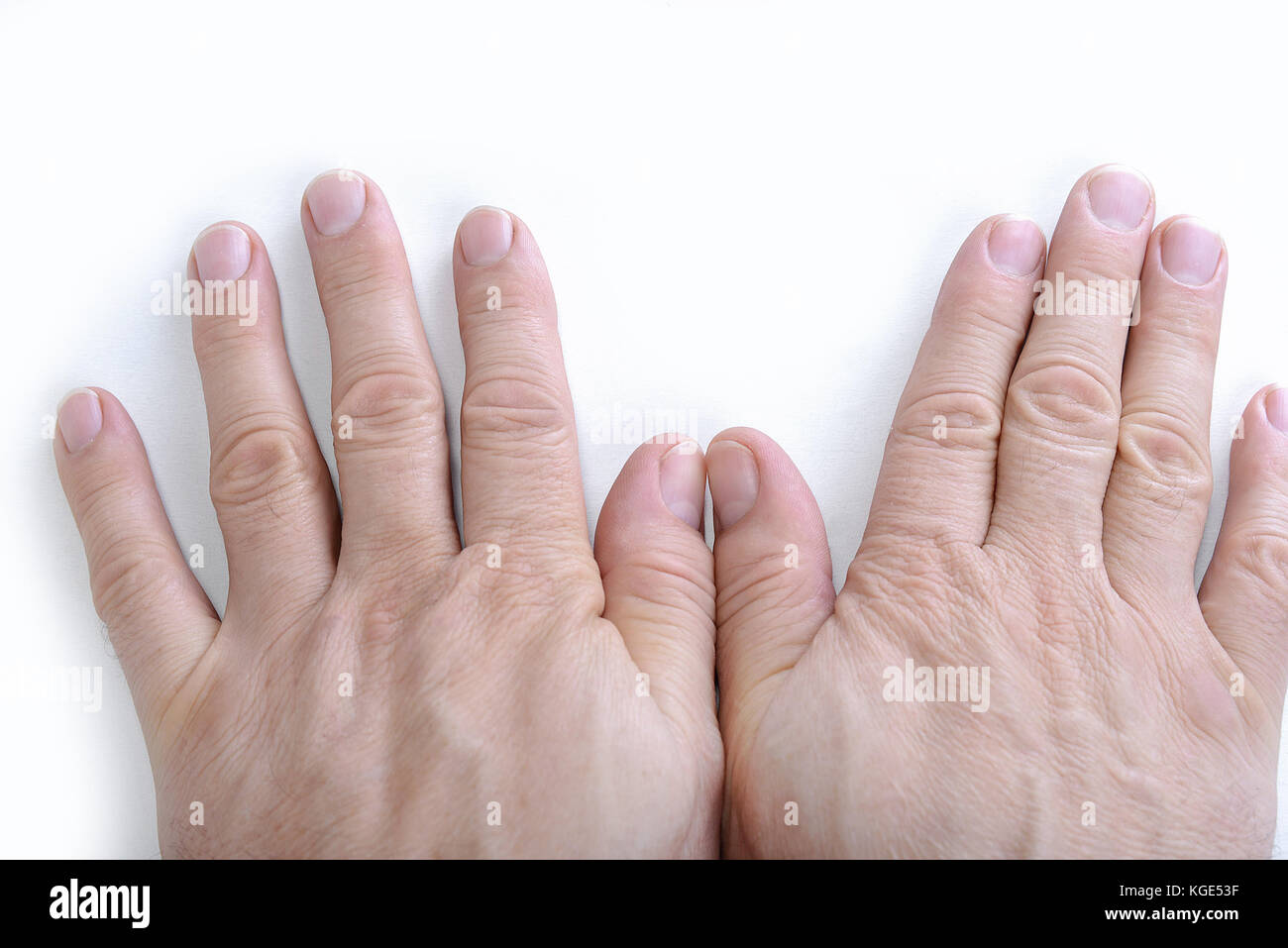 Caucasian male hand showing nails on white background Stock Photo - Alamy